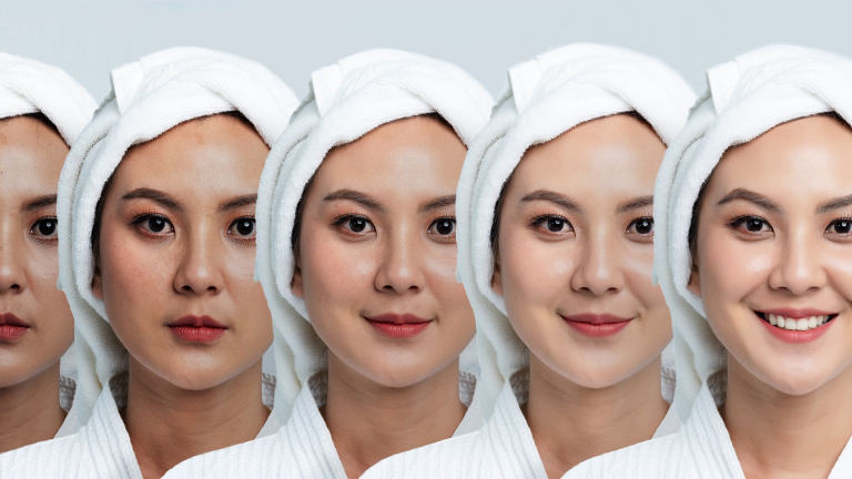 Skin Rejuvenation: 7 Treatments You Should Know for Your Skin